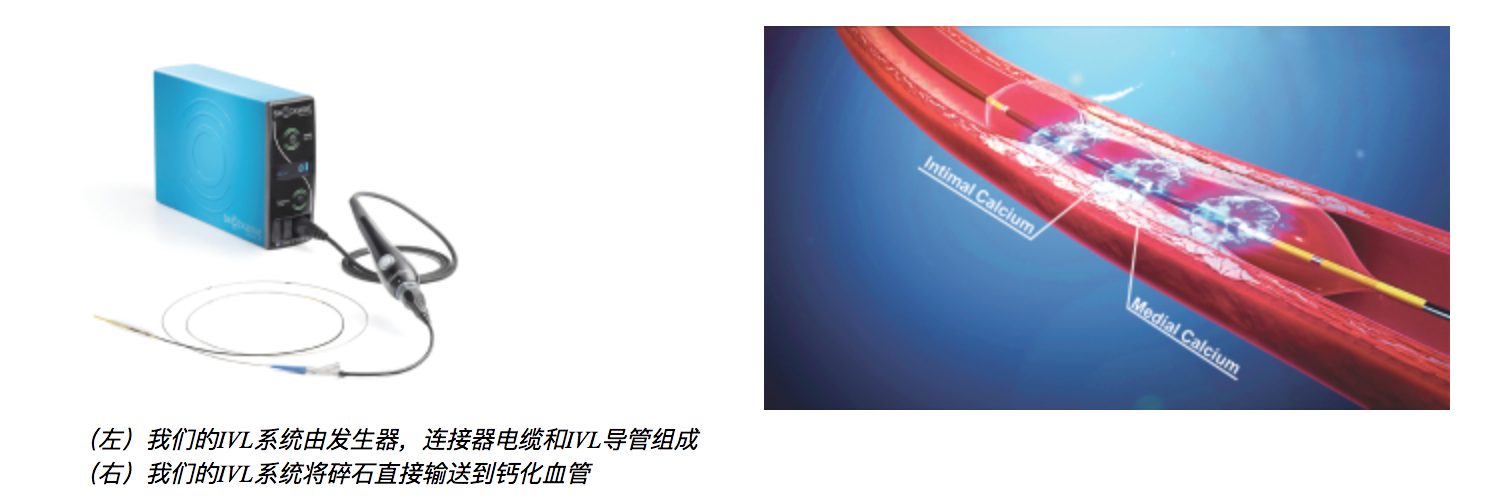 Shockwave Medical, Inc .美股 IPO_老虎社区_美港股上老虎 - 老虎社区